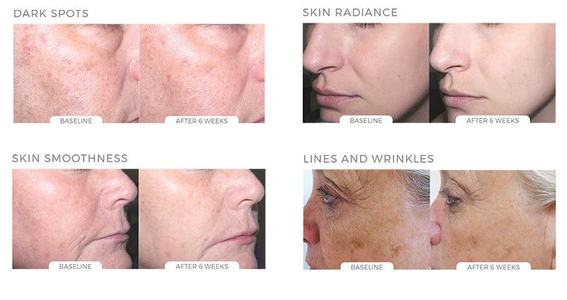 SKIN BRIGHTENING SYSTEM (Save $43) – Island Cosmeceuticals